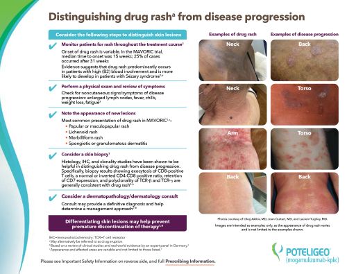 Download Educational Resources | POTELIGEO® (mogamulizumab-kpkc)